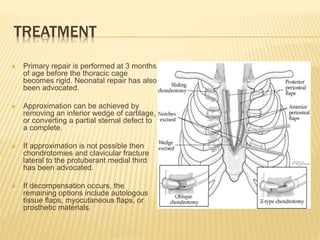 Congenital chest wall anomalies | PPT