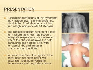 Congenital chest wall anomalies | PPT