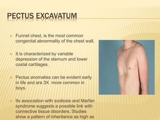 Congenital chest wall anomalies | PPTX