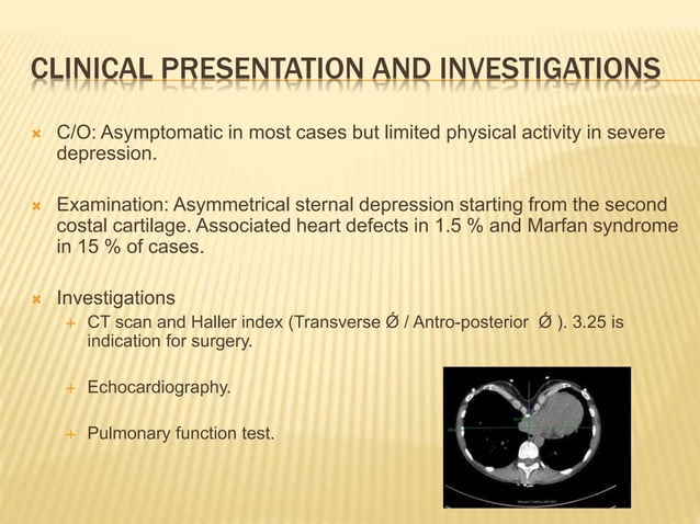 Congenital chest wall anomalies | PPTX