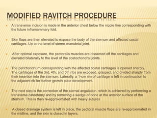 Congenital chest wall anomalies | PPTX