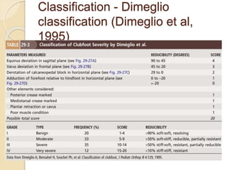 Congenital clubfoot | PPTX