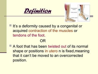 a brief explaination about congenital club foot.ppt