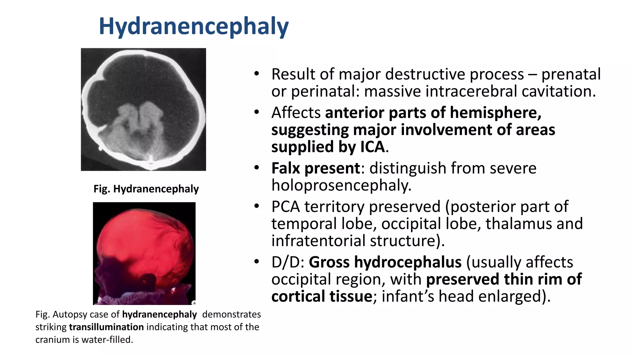Congenital CNS lesions | PPTX