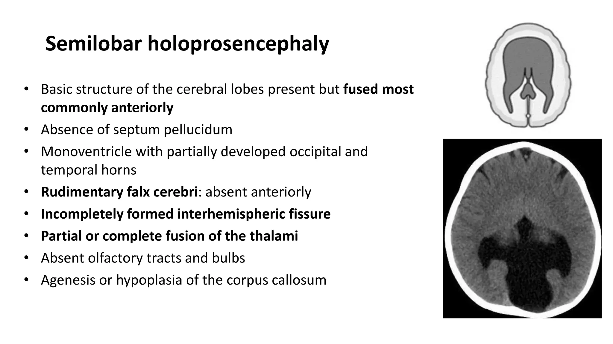 Congenital CNS lesions | PPTX
