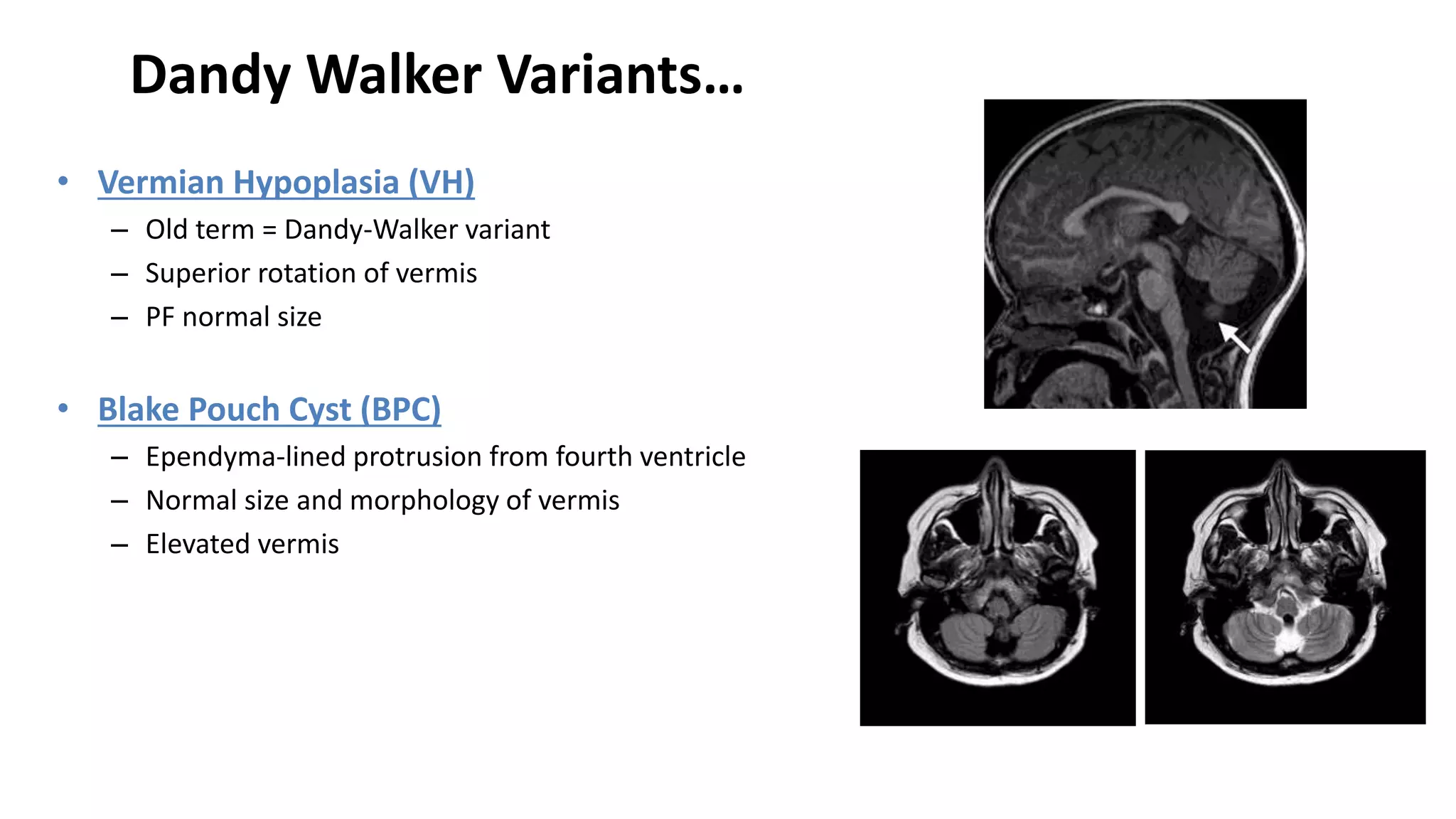 Congenital CNS lesions | PPTX