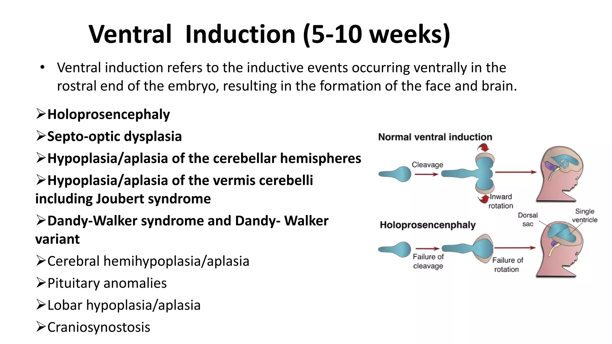 Congenital CNS lesions | PPTX