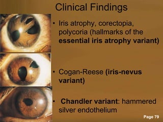 Congenital corneal disorders | PPTX