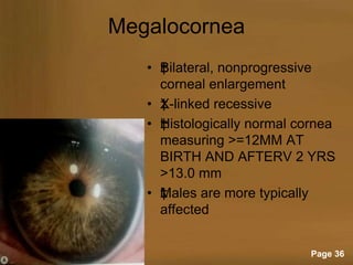 Megalocornea
