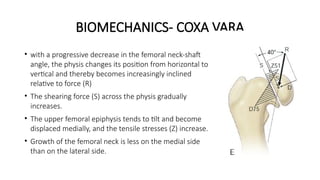 Presentation on topic Congenital coxa vara | PPTX