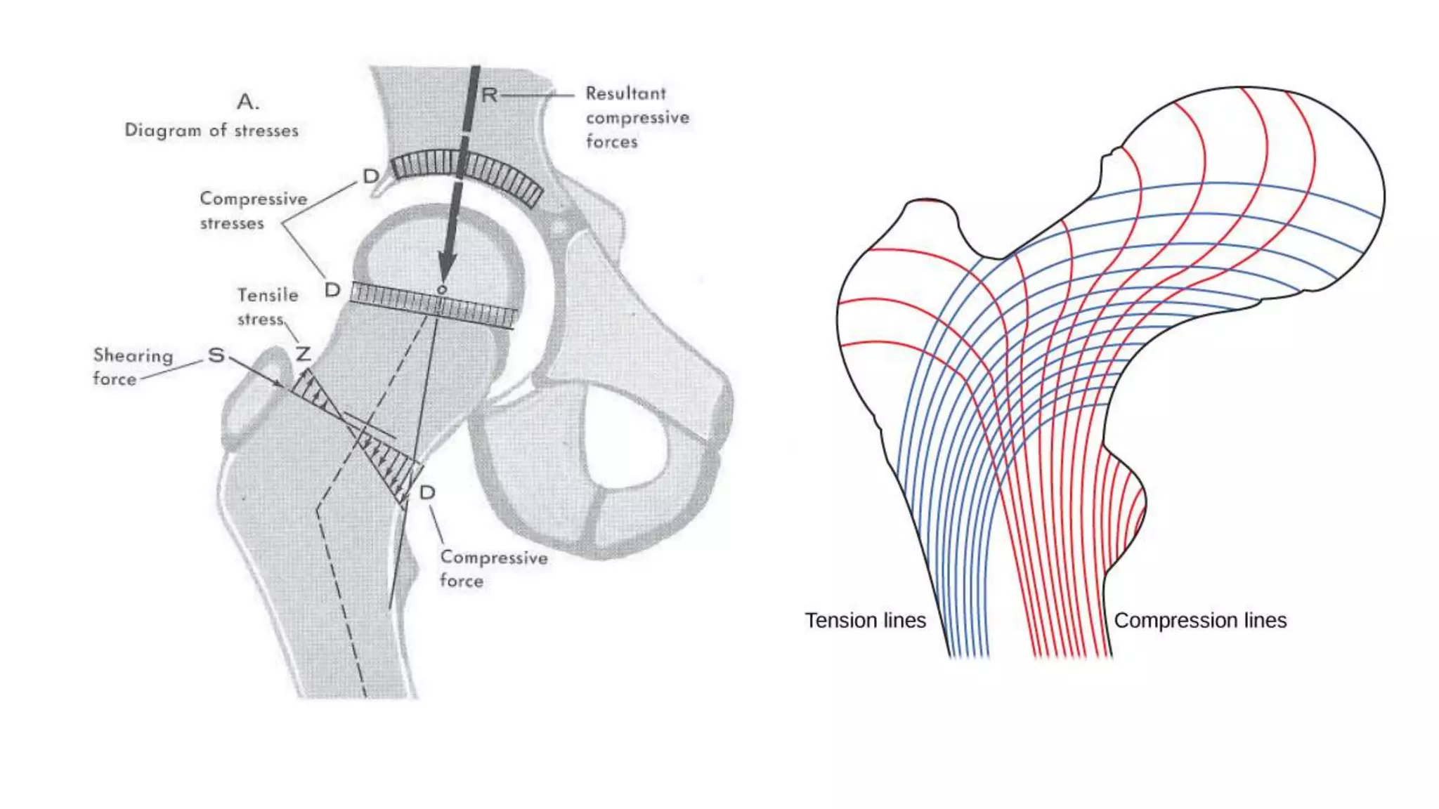 Congenital coxa vara | PPT