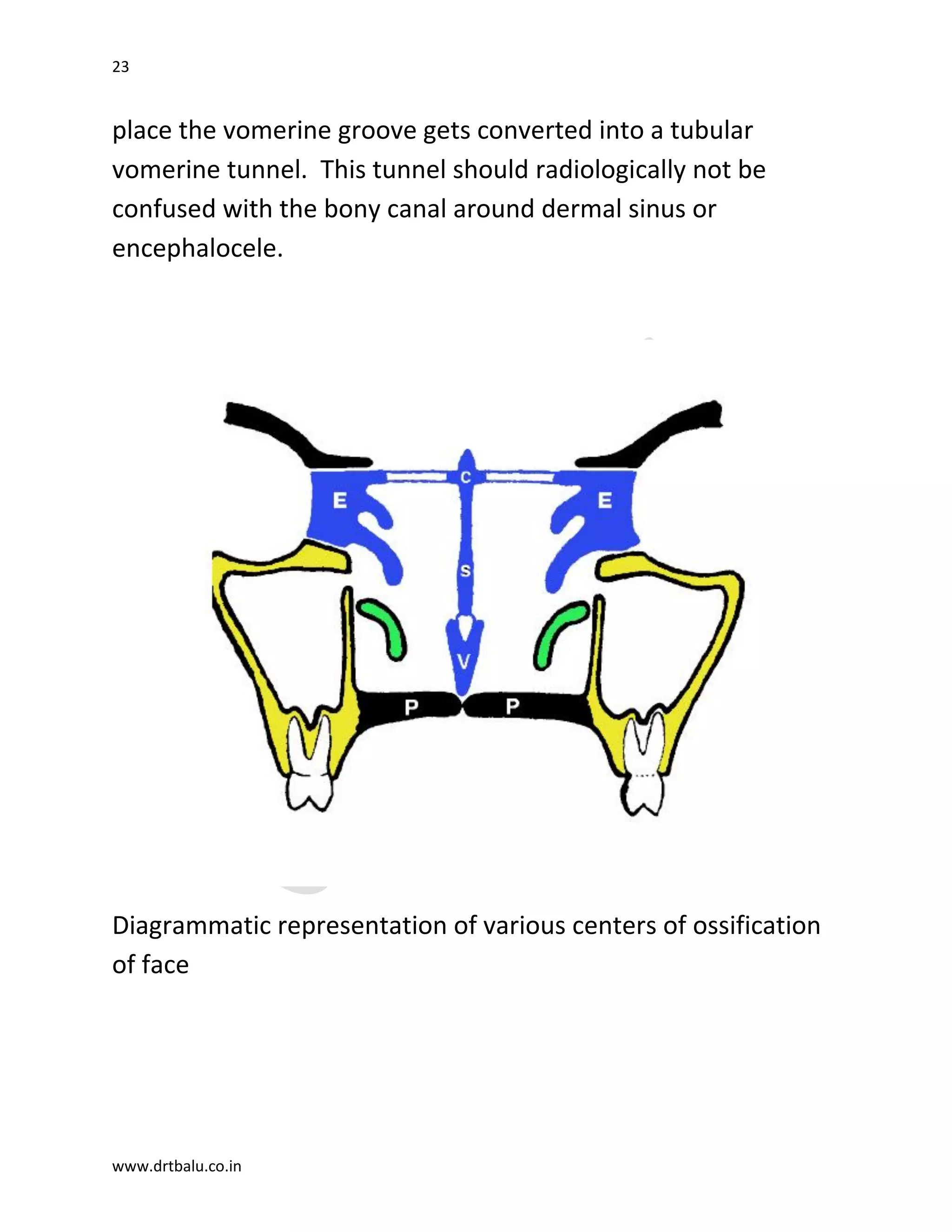 Congenital craniofacial malformations | PDF