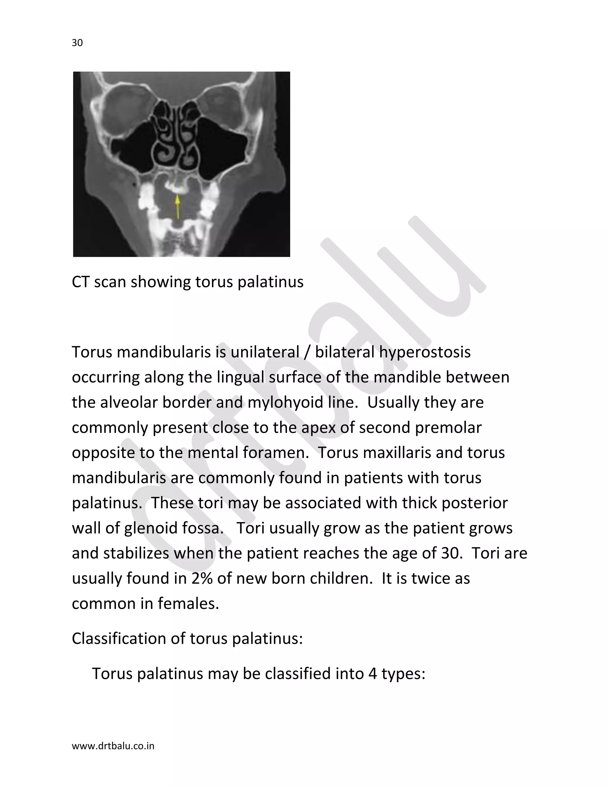 Congenital craniofacial malformations | PDF