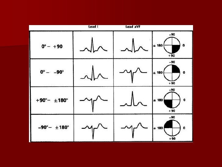 Congenital cyanotic heart disease approach