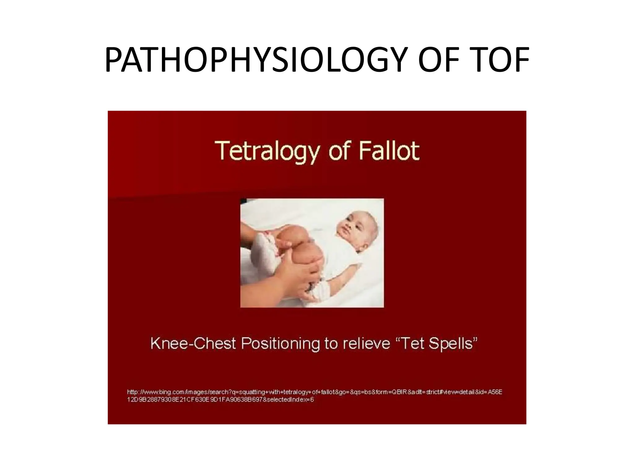 CONGENITAL CYANOTIC HEART DISEASES I - ABSUTH.pptx