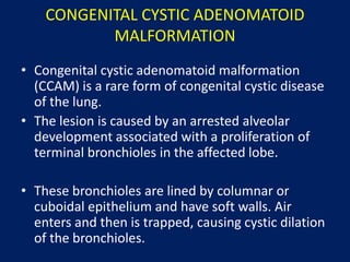 Congenital cystic diseases of the lung | PPTX