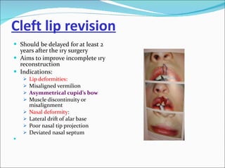 Congenital defects of the Face | PPT