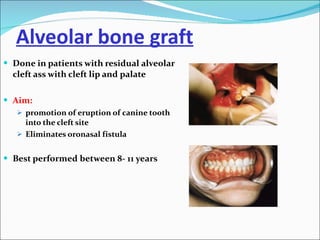 Congenital defects of the Face | PPT | Ear, Nose and Throat Conditions ...