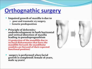Congenital defects of the Face | PPT