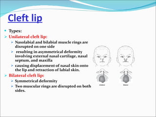 Congenital defects of the Face | PPT