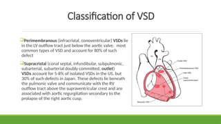 congenital defects of the heart in adults.pptx