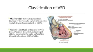 congenital defects of the heart in adults.pptx