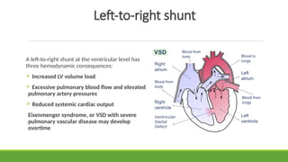 congenital defects of the heart in adults.pptx