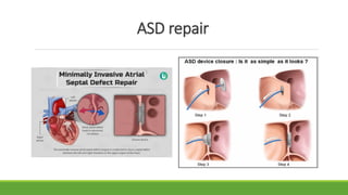 congenital defects of the heart in adults.pptx