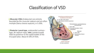 congenital defects of the heart in adults.pdf