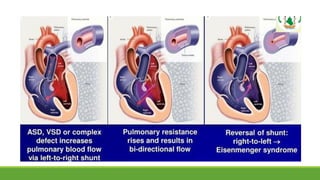 congenital defects of the heart in adults.pdf