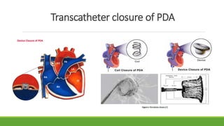 congenital defects of the heart in adults.pdf