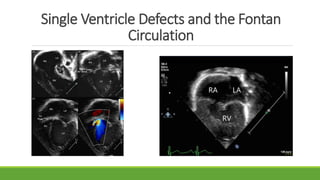 congenital defects of the heart in adults.pdf