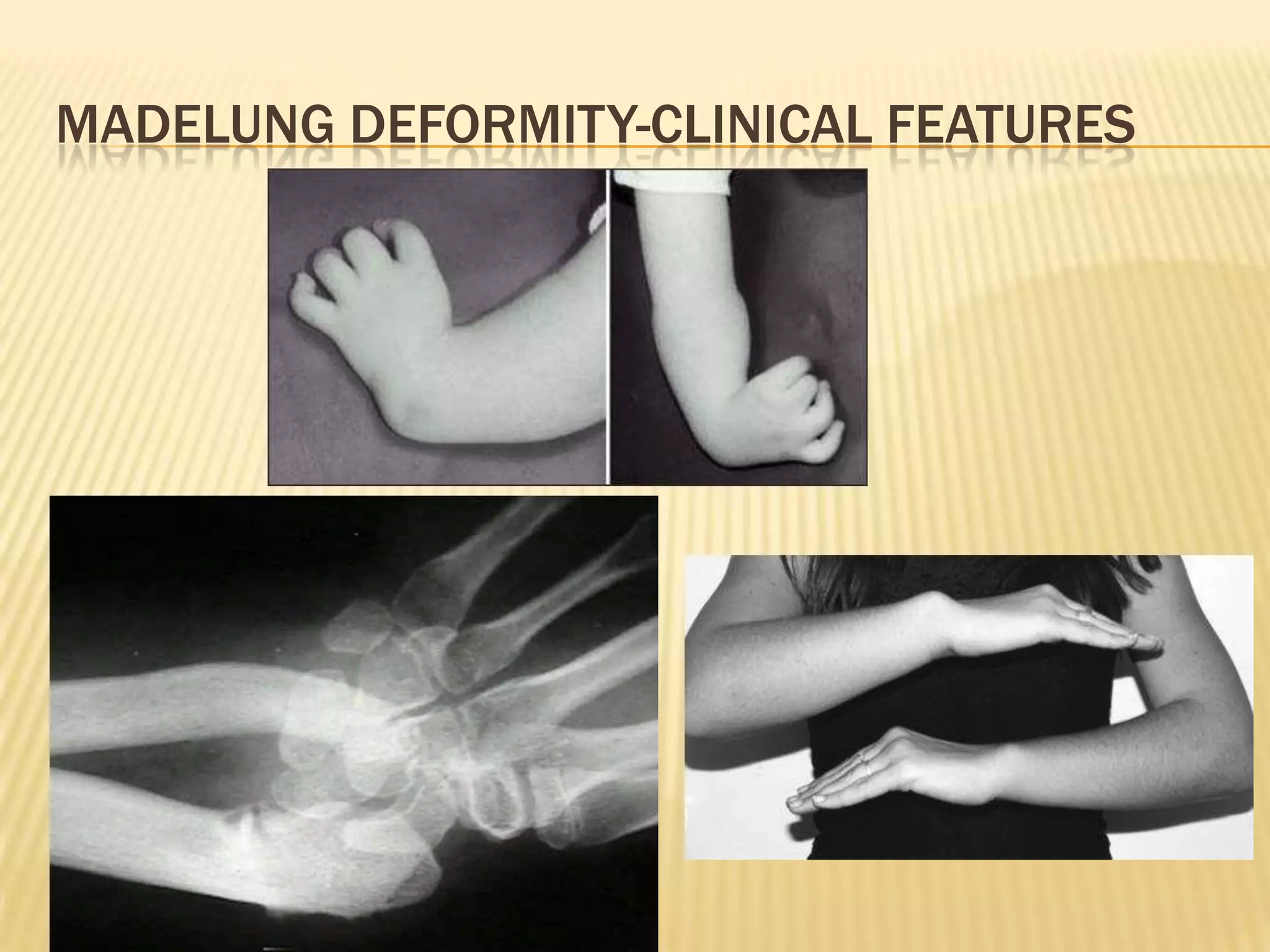 Congenital deformities | PPTX