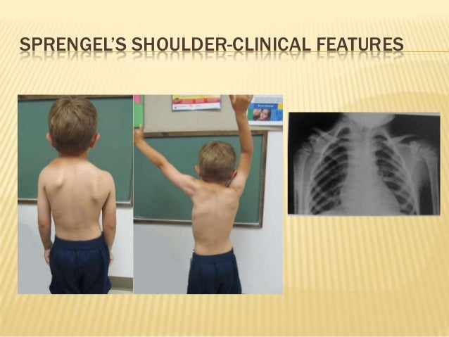 Congenital deformities