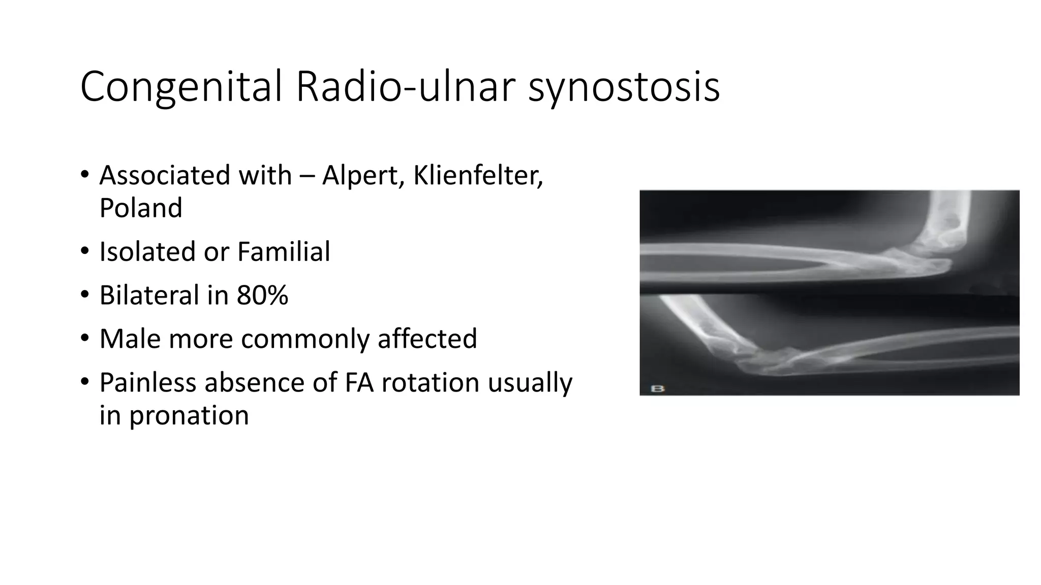 Congenital and Acquired Deformities around Elbow.pptx