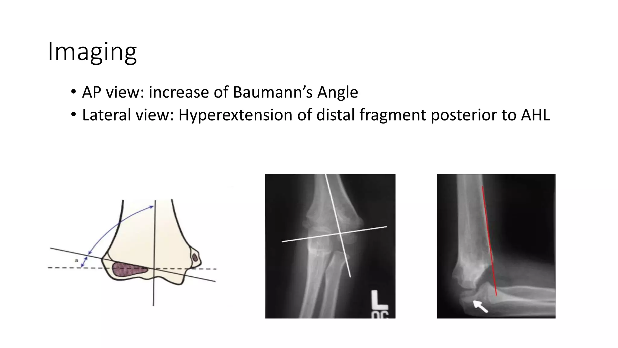 Congenital and Acquired Deformities around Elbow.pptx