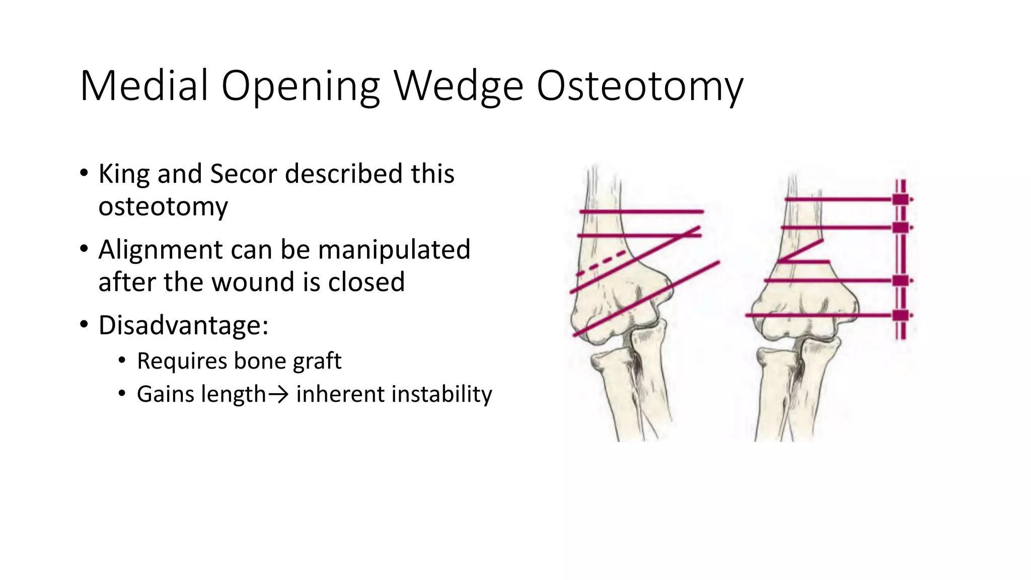 Congenital and Acquired Deformities around Elbow.pptx