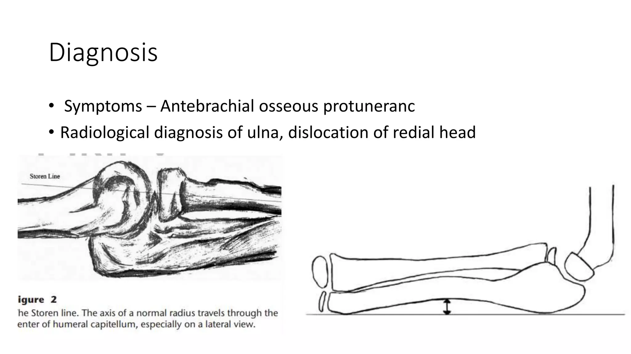 Congenital and Acquired Deformities around Elbow.pptx