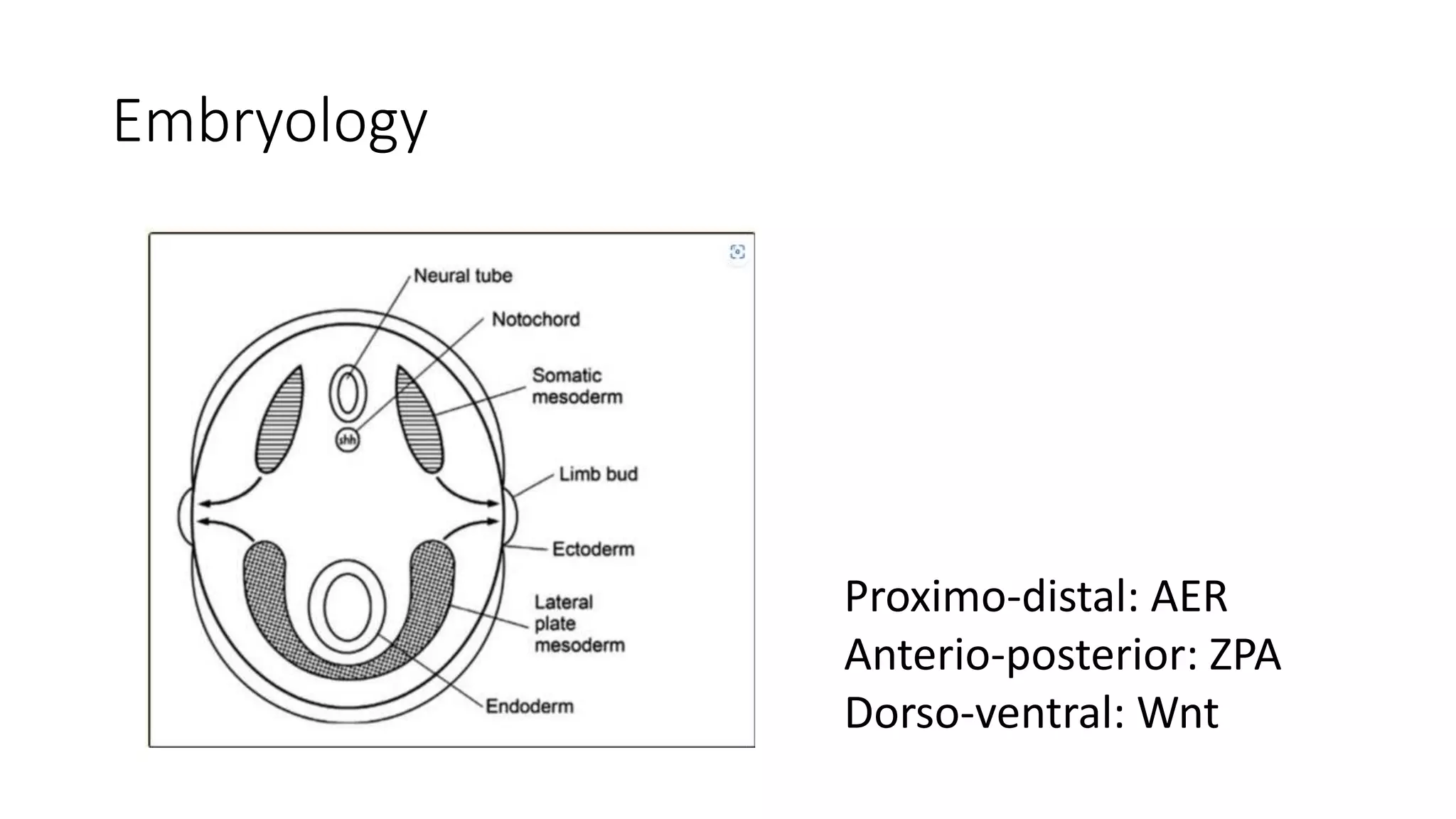 Congenital and Acquired Deformities around Elbow.pptx