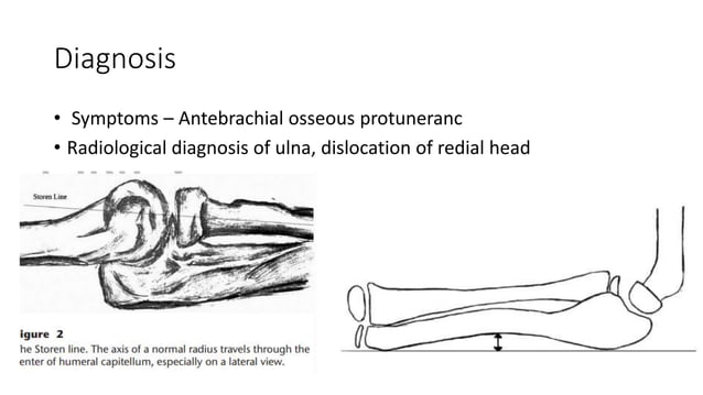 Congenital and Acquired Deformities around Elbow.pptx