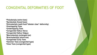 CONGENITAL DEFORMITIES OF FOOT-1.pptx and | PPTX