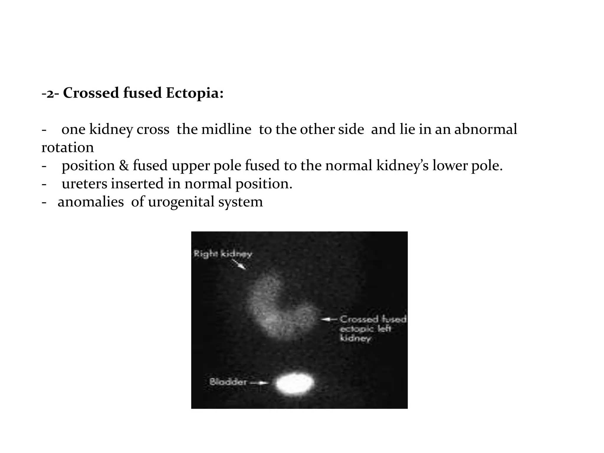 Congenital Development of Urinary System.pptx