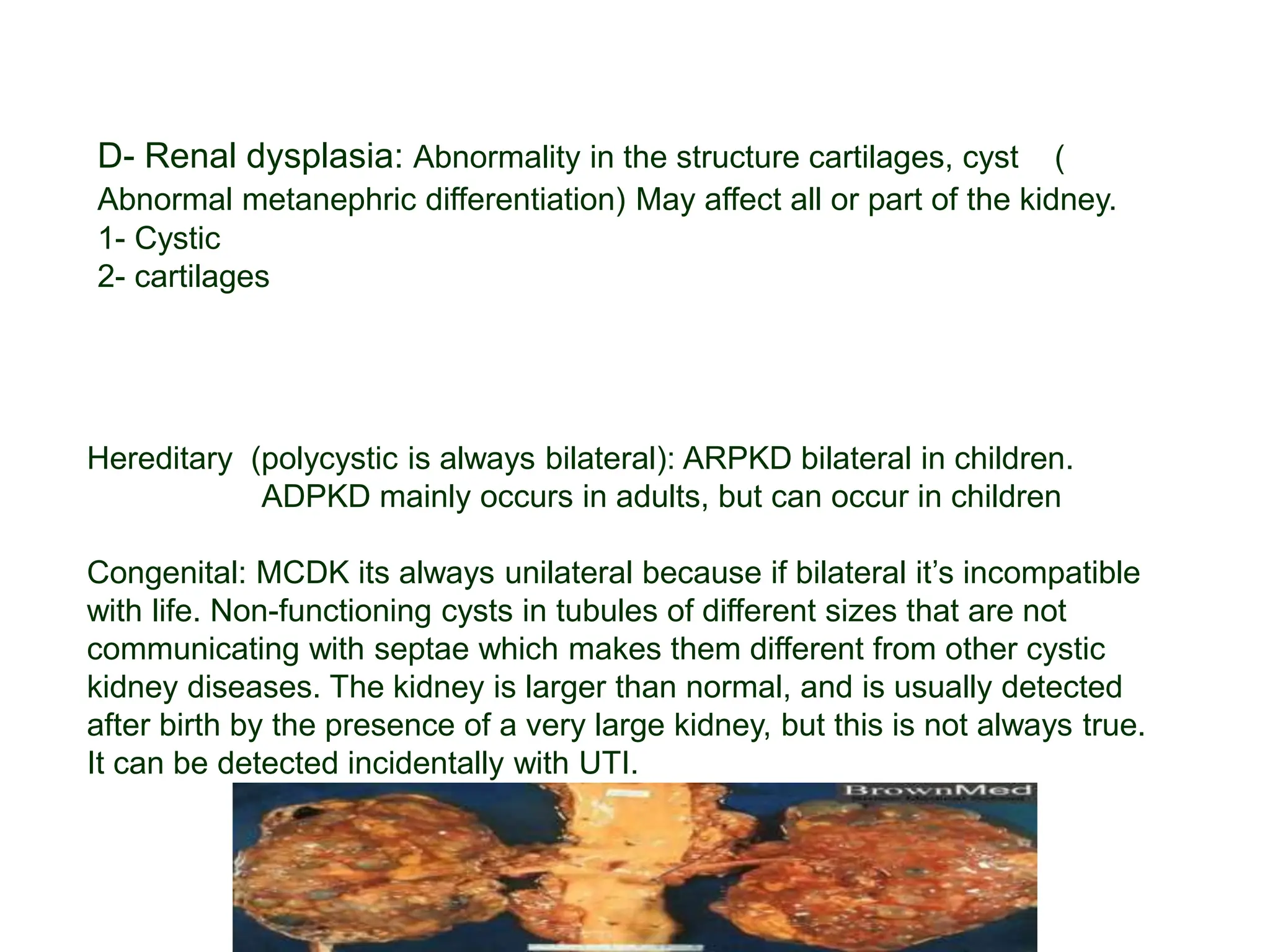 Congenital Development of Urinary System.pptx