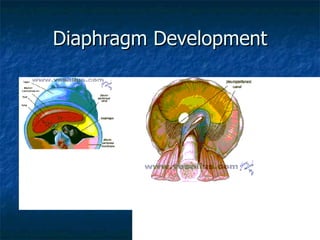 Congenital Diaphragmatic Hernia | PPT
