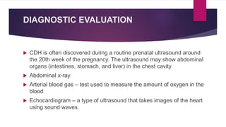 Congenital Diaphragmatic Hernia | PPTX