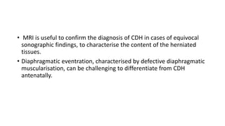 Congenital diaphragmatic hernia | PPTX