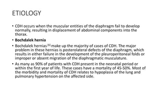 Congenital diaphragmatic hernia | PPTX