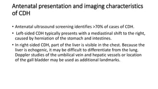 Congenital diaphragmatic hernia | PPTX