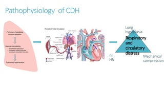 congenitaldiaphragmatichernia.pptx