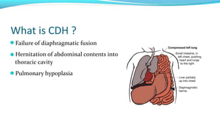 congenitaldiaphragmatichernia.pptx